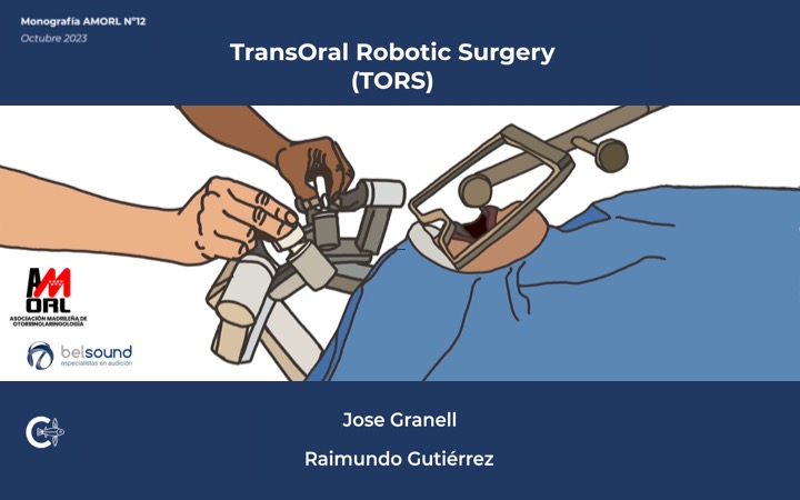 Monografía TORS – Head and Neck Robotic Surgery