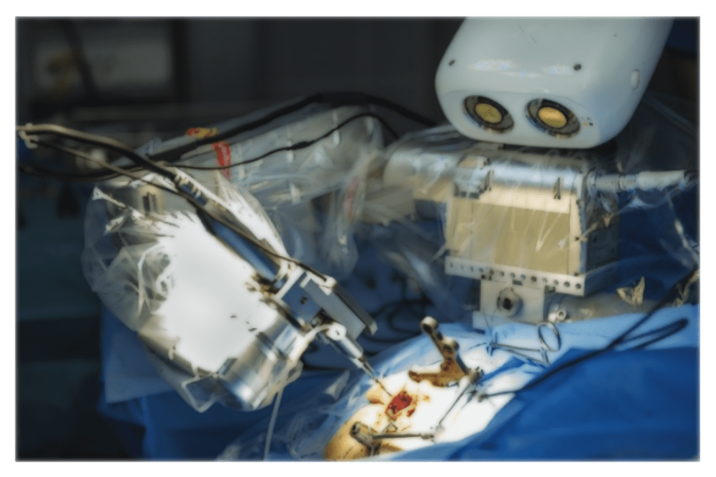 Robotic Systems for Otologic Surgery – Head and Neck Robotic Surgery
